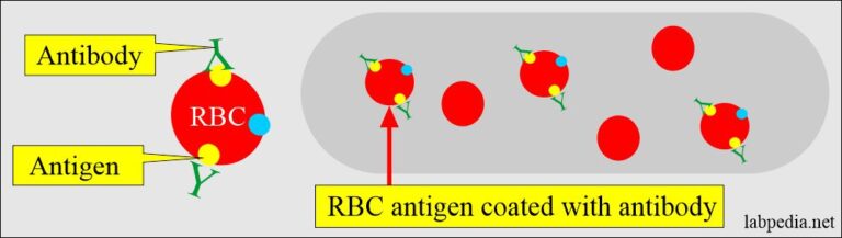 Coomb's test direct for the detection of antibody