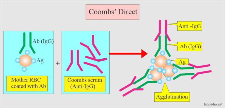 Coomb's test direct for the detection of antibody