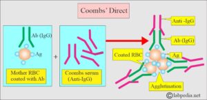 Coomb's test direct for the detection of antibody