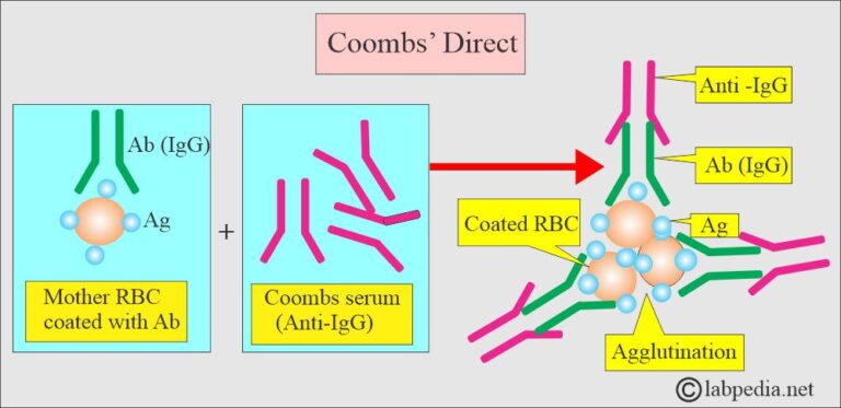 Coomb's test direct for the detection of antibody
