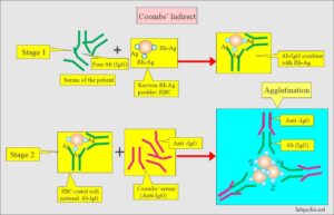 Hemolytic disease of newborn (HDN), and coombs test