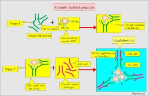 Coombs' Indirect test, (anti-globulin indirect test)