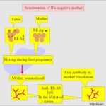 Coombs' Indirect test, (anti-globulin indirect test)