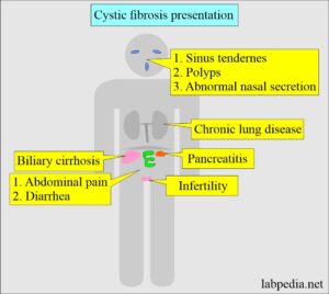 Sweat Electrolytes, Cystic Fibrosis and Diagnosis - Labpedia.net