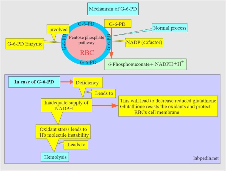 Glucose-6-phosphate Dehydrogenase deficiency (G6PD deficiency ...