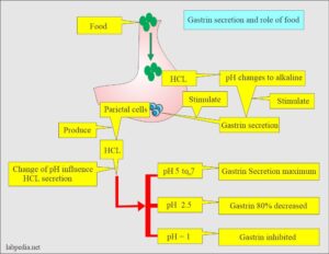 Zollinger-Ellison Syndrome, gastrinoma