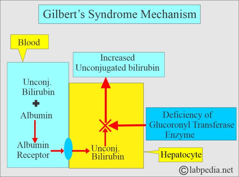 Gilbert's Syndrome, Signs/Symptoms and Diagnosis - Labpedia.net