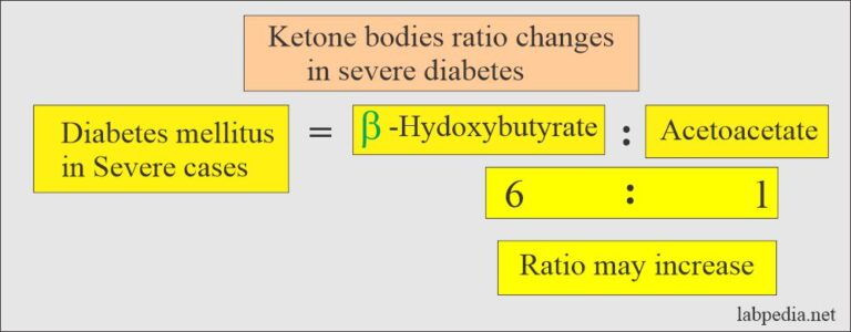 Diabetic Ketoacidosis Ketone Bodies And Management