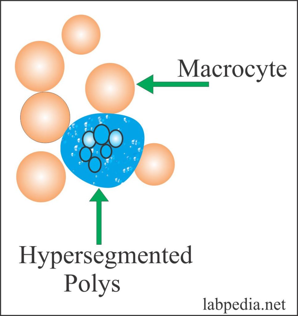 Mean Corpuscular Hemoglobin (MCH), Mean Cell Hemoglobin - Labpedia.net