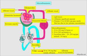 Urine Albumin 24 hours, Microalbuminuria - Labpedia.net