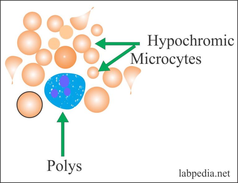 Mean Corpuscular Hemoglobin (MCH), Mean Cell Hemoglobin - Labpedia.net