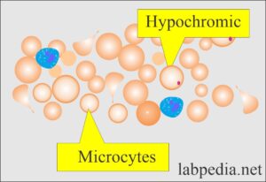 Red Blood Cell (RBC):- Part 5 - Summary of RBC Morphology ...