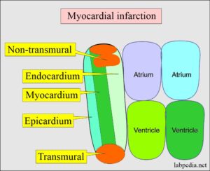 Cardiac marker:- Part 1 - Diagnosis of Acute Myocardial Infarction, AMI ...