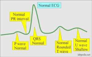 Potassium (K+) in blood and its significance
