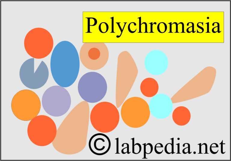 Anemia classification, diagnosis, and routine workup