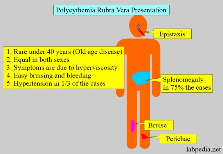 Polycythemia (Erythrocytosis), Polycythemia Rubra Vera, and Secondary ...