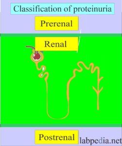 Urine protein 24-hour, Classification of Proteinuria - Labpedia.net
