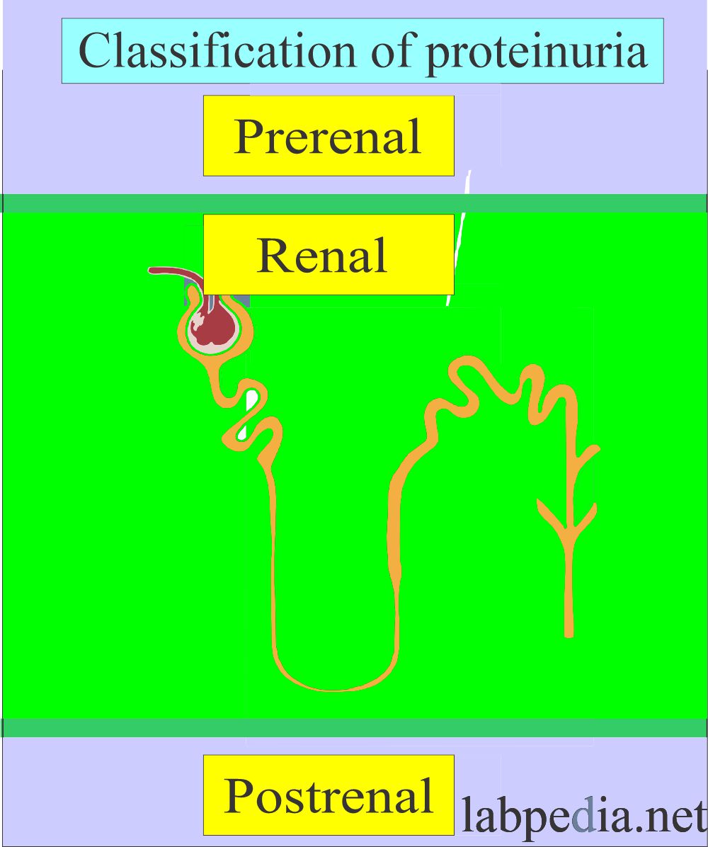 Urine Protein Proteinuria Spot Test Microalbuminuria Labpedia Urine Protein Proteinuria Spot Test Microalbuminuria Labpedia