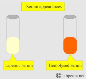 Blood samples That should be Discarded (Rejected) - Labpedia.net