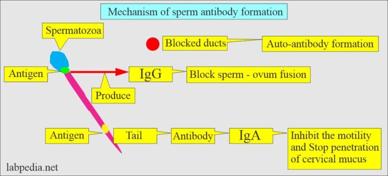Semen:- part 3 - Anti-Sperm-antibody - Labpedia.net