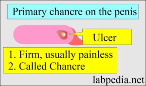 Syphilis:- Part 1- Syphilis Presentation (Treponema Pallidum ...
