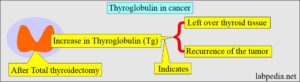 Tumor Marker:- Part 10 - Thyroglobulin (Tg) as Tumor marker - Labpedia.net