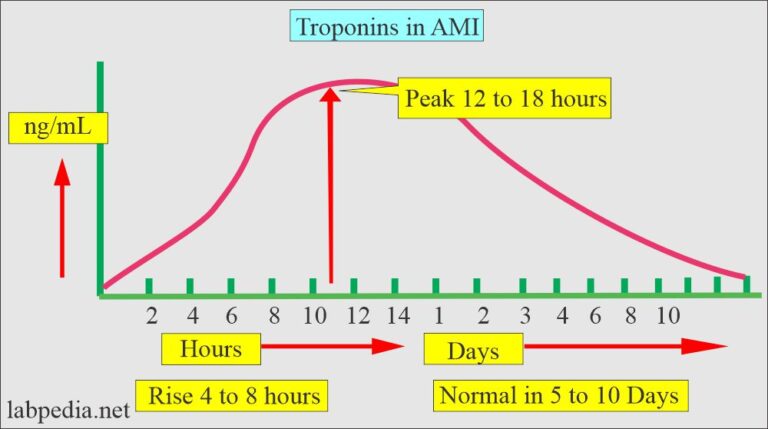 Cardiac Marker:- Part 3 -Troponin-T, and Troponin-I - Labpedia.net