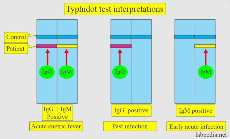 Typhidot Test for Diagnosis of Enteric Fever