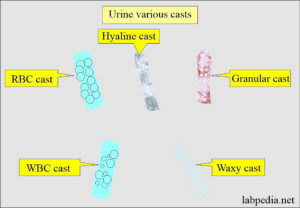 Urine Analysis:- Part 1 - Complete Urine Analysis Discussion - Labpedia.net