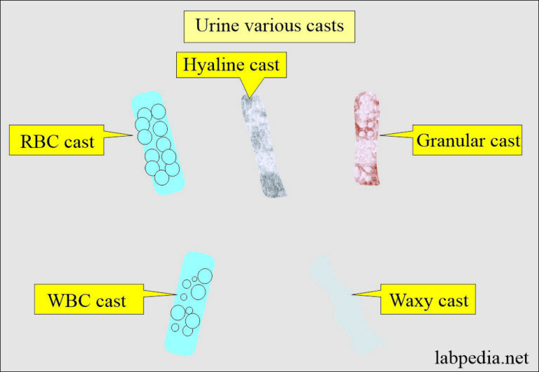 Urine Analysis:- Part 1 - Complete Urine Analysis Discussion - Labpedia.net