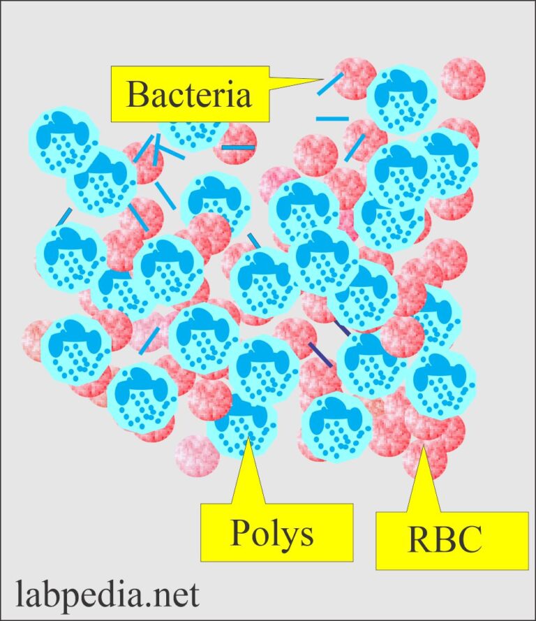 Urine Analysis:- Part 1 - Complete Urine Analysis Discussion - Labpedia.net