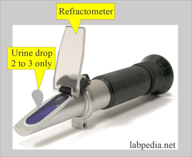 Urine Analysis:- Part 3 - Urine Physical Examination and ...