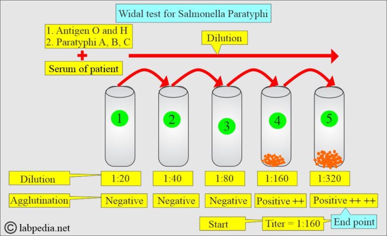 Salmonella Paratyphi, Paratyphoid Fever, Diagnosis and Treatment