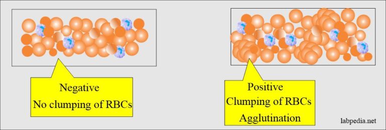 Chapter 6: Immunological (Antigen and Antibody) Reactions, Monoclonal ...