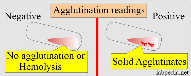 Chapter 6: Immunological (Antigen and Antibody) Reactions, Monoclonal ...