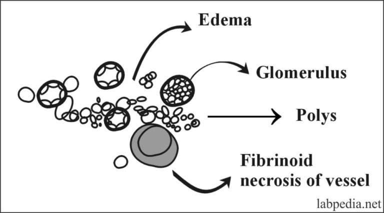 Chapter 15: Transplantation and Rejection Phenomenon - Labpedia.net
