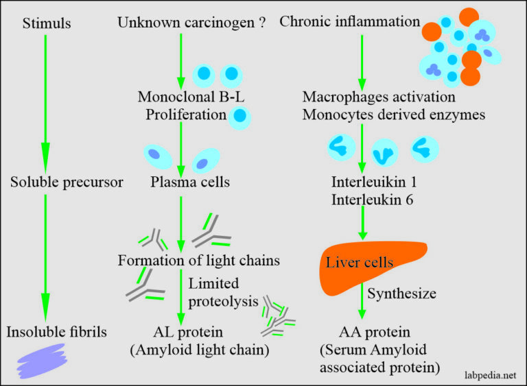 Chapter 33: Amyloidosis - Labpedia.net