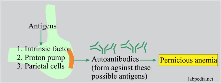 Chapter 22: Autoimmune diseases, Pernicious Anemia (Vitamin B12 ...