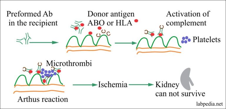 Chapter 15: Transplantation and Rejection Phenomenon - Labpedia.net