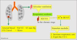 Acid-base Balance:- Part 3 - Respiratory Acidosis and Alkalosis ...