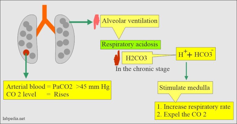 Respiratory Acidosis