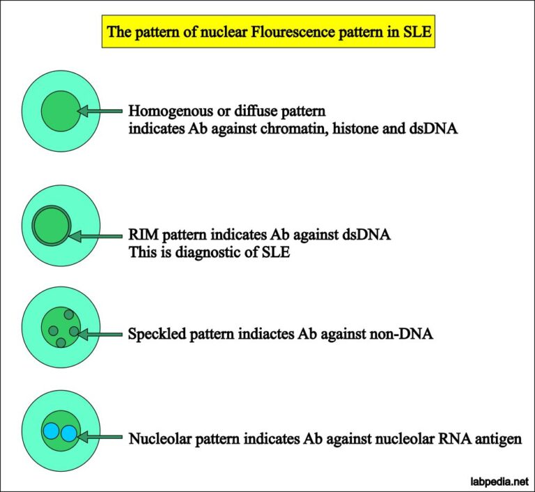 Chapter 17: Autoimmune Diseases:- Systemic Lupus erythematosus (SLE ...