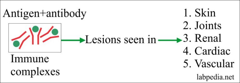 Chapter 17: Autoimmune Diseases:- Systemic Lupus erythematosus (SLE ...