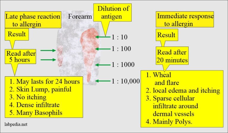 Chapter 11:- Type 1 Hypersensitivity reaction, Anaphylaxis, Atopy, and ...