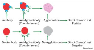 Chapter 12: Type II Hypersensitivity Reaction and ADCC (Cytotoxic ...
