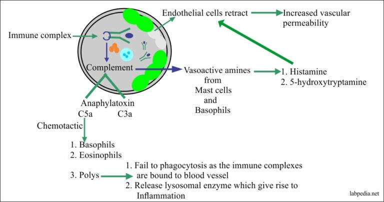 Chapter 13: Hypersensitivity Reaction Type III, Immune Complex Disease - Labpedia.net