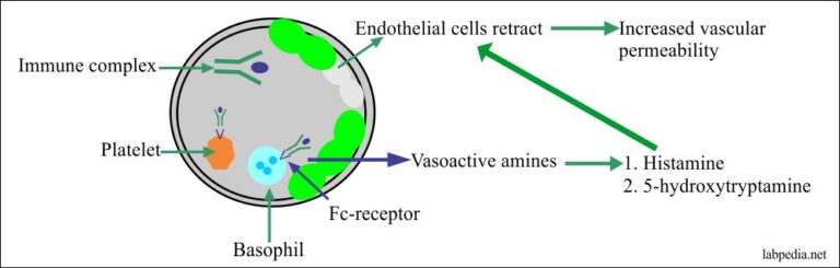 Chapter 13: Hypersensitivity Reaction Type III, Immune Complex Disease ...