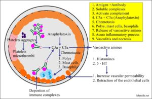 Chapter 13: Hypersensitivity Reaction Type III, Immune Complex Disease ...