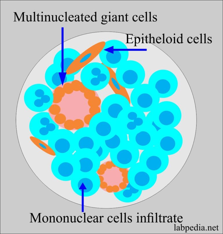 Chapter 14: Hypersensitivity Reaction Type IV, Cell Mediated Delayed ...