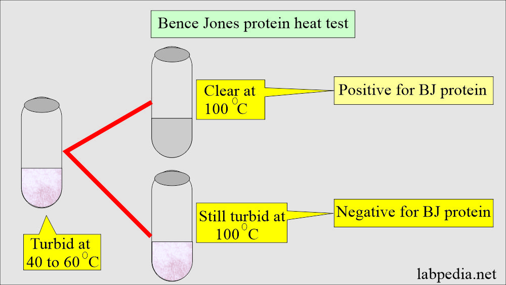 Urine Analysis Chemical Examination And Interpretations Part 4 Urine Analysis Chemical Examination And Interpretations Part 4